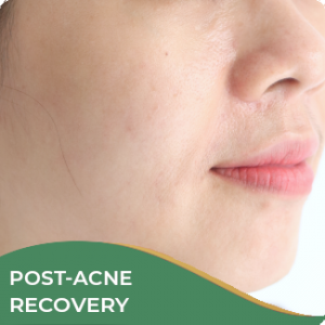 Doctor Acnes Dermatology Clinic - Medical standard Acne and Scar Treatment