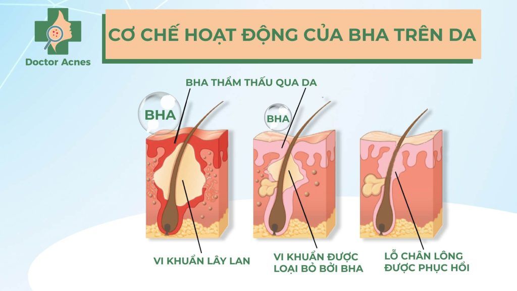 6 điều cần lưu ý khi dùng BHA để không bị kích ứng khi dùng