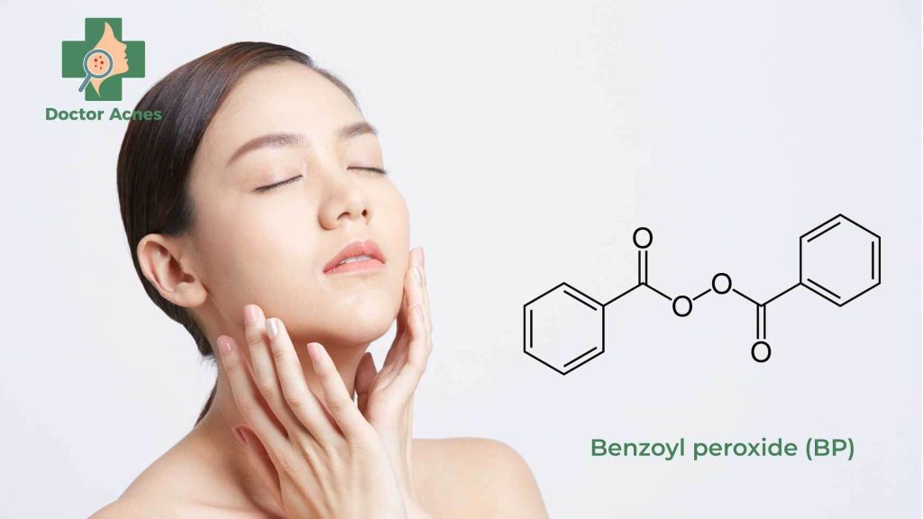 Trị mụn nên dùng acid salicylic hay benzoyl peroxide?