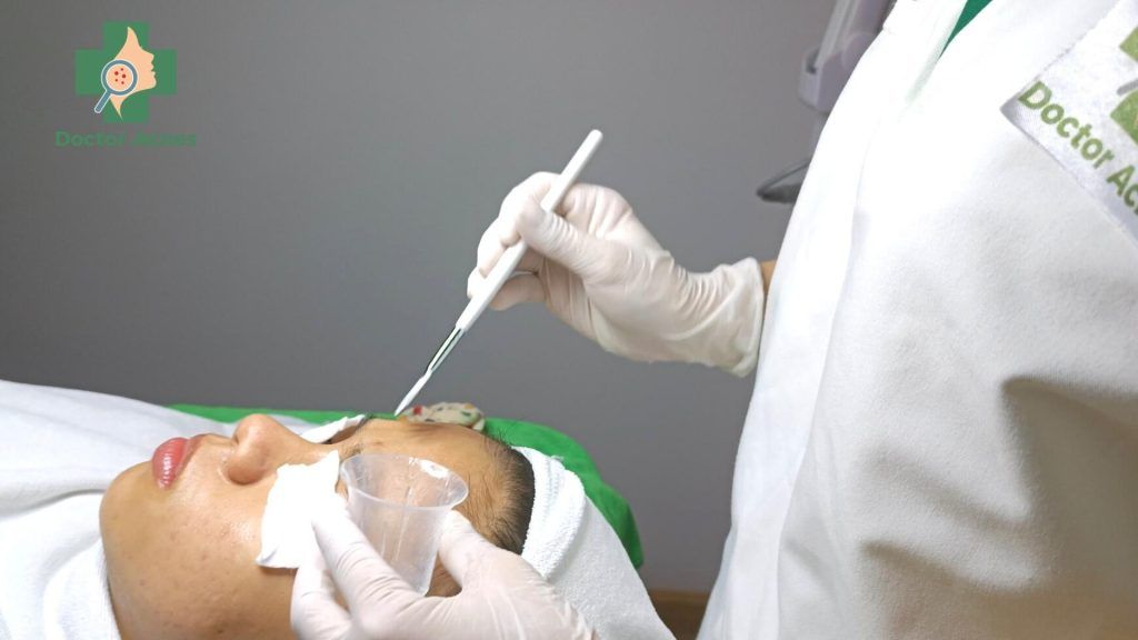 Peel da có làm mỏng da không? Chăm sóc da đúng cách sau peel