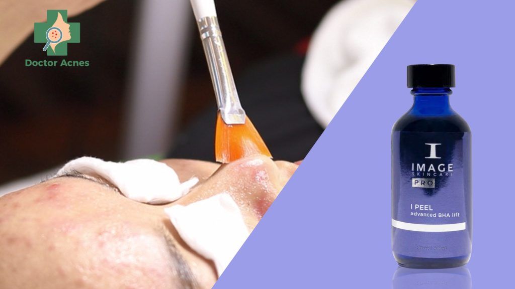 Peel da trị mụn giá bao nhiêu tiền tại Phòng Khám Doctor Acnes