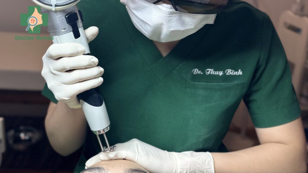 Laser fractional Nd:YAG trong điều trị sẹo rỗ - Phòng khám Da liễu ...