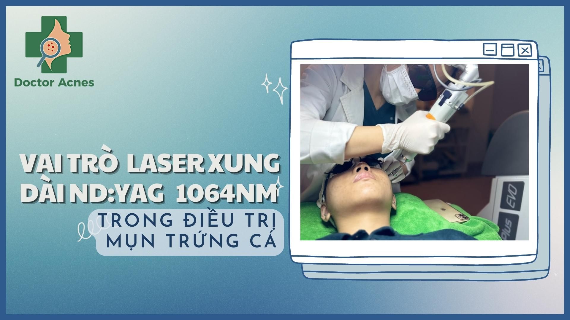 Laser xung dài là gì? Vai trò của laser xung dài trong trị mụn