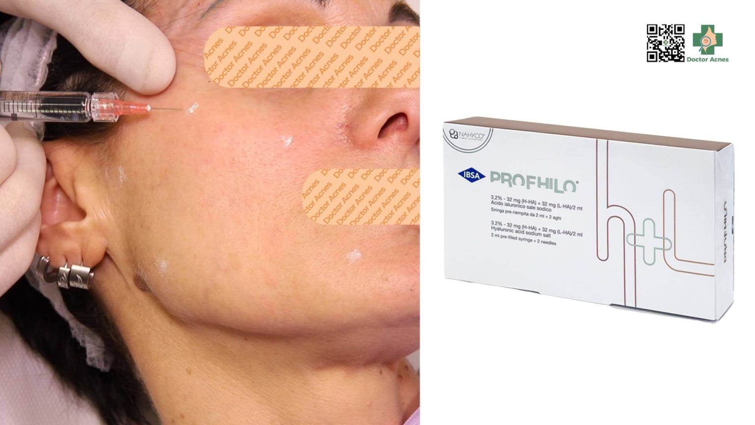 Tiêm BAP và tiêm meso khác nhau như thế nào?