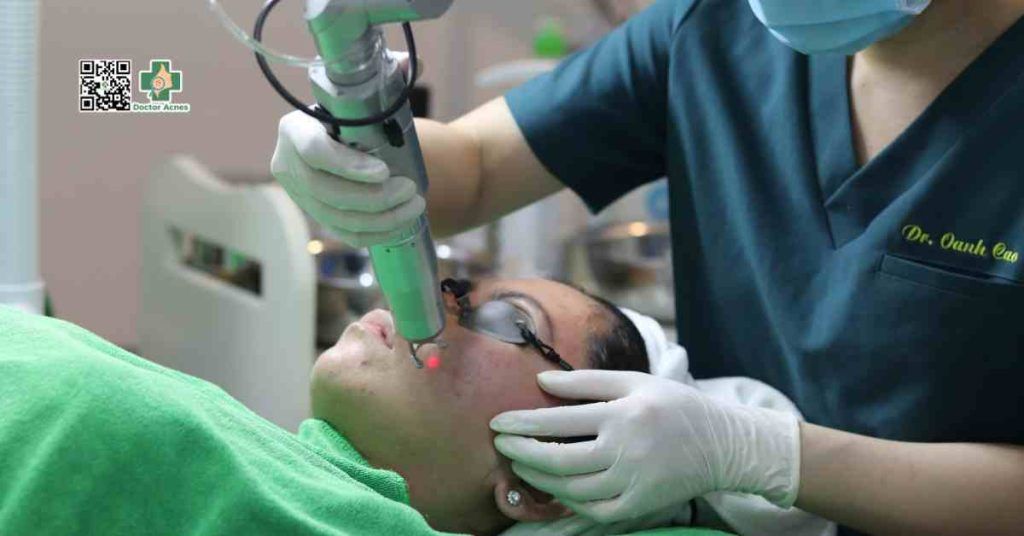 So sánh laser 1064nm xung dài với laser nhuộm xung PDL trong trị mụn