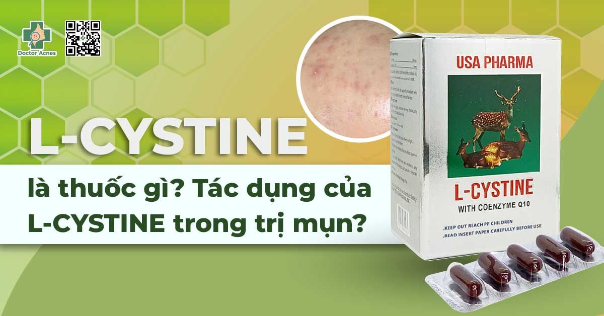 L-Cystine là thuốc gì? L-Cystine có tác dụng gì trong trị mụn