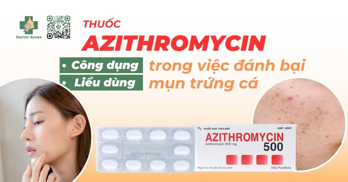 Thuốc azithromycin: công dụng và liều dùng trong trị mụn trứng cá
