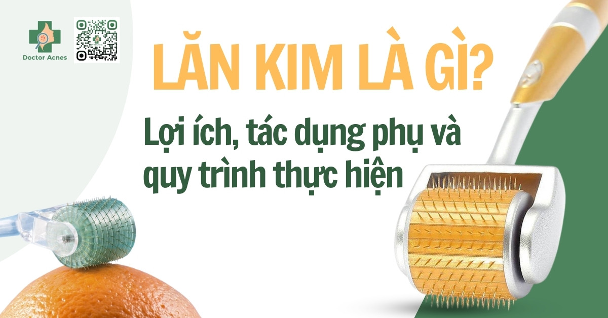 Lăn kim là gì? Tác dụng của lăn kim đối với làn da