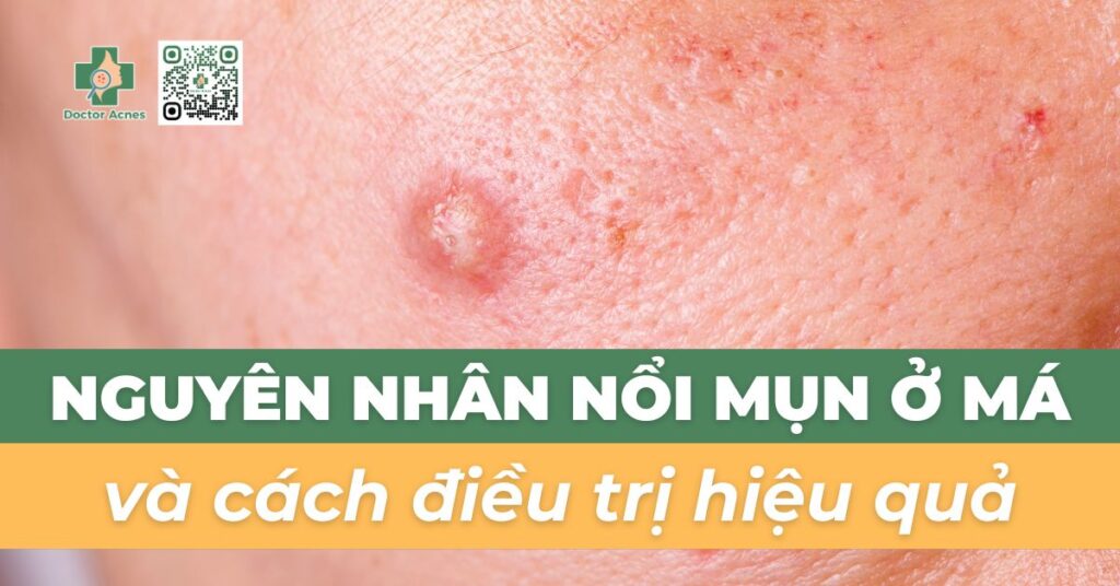 Mọc mụn trong mũi: nguyên nhân và phương pháp điều trị