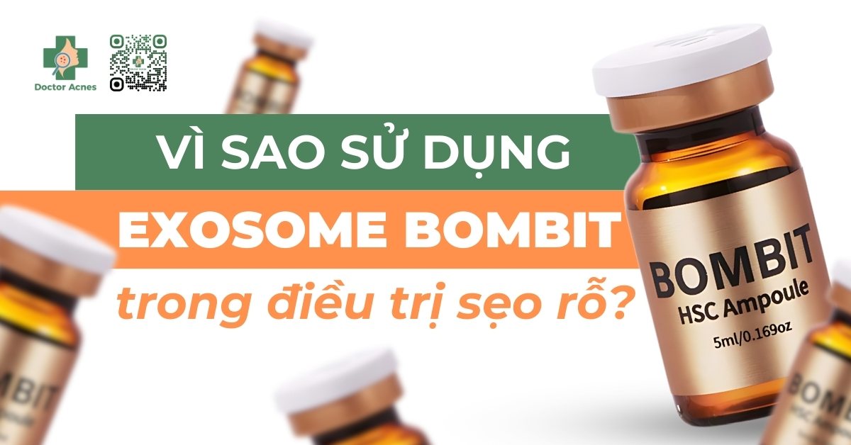 Vì sao sử dụng exosome BOMBIT điều trị sẹo rỗ?