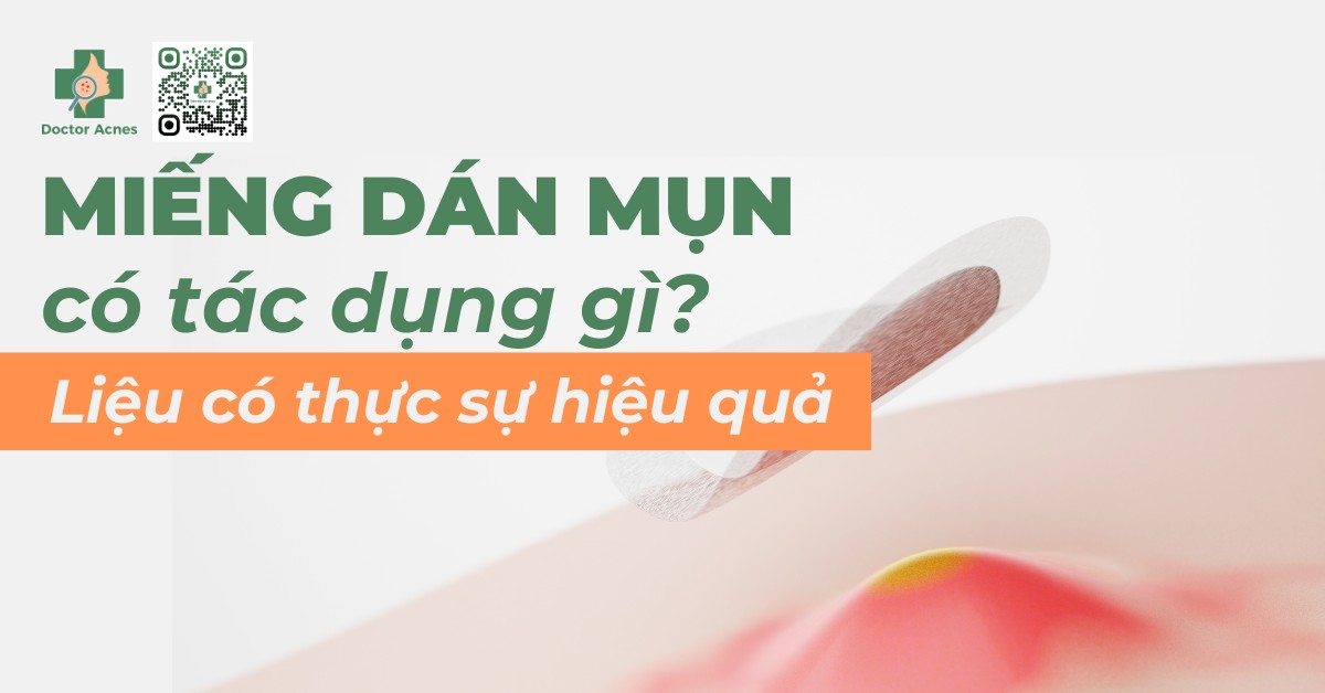 Miếng dán mụn có tác dụng gì? Liệu có thật sự hiệu quả?