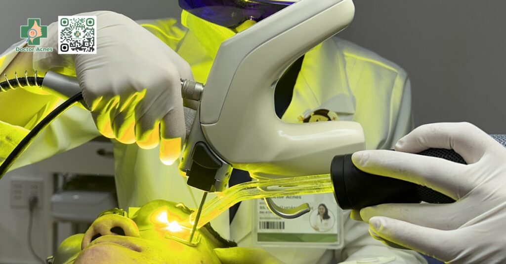 Trị sẹo lồi bằng laser giá bao nhiêu? Bảng giá mới nhất năm 2026