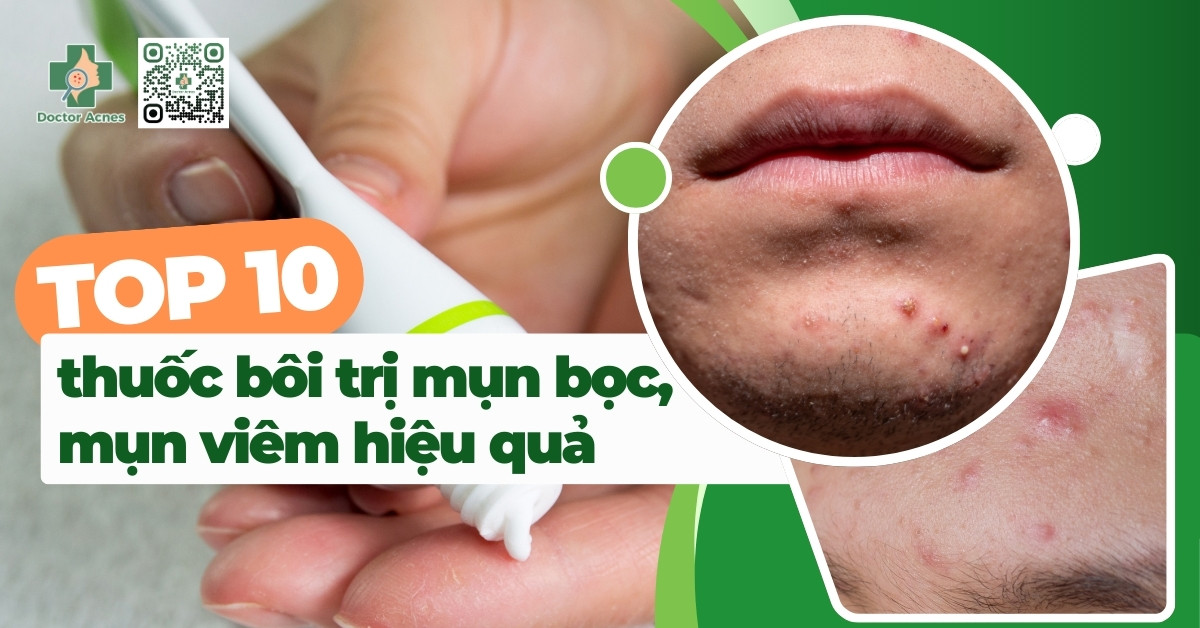 Top 10 thuốc trị mụn bọc hiệu quả nhất hiện nay