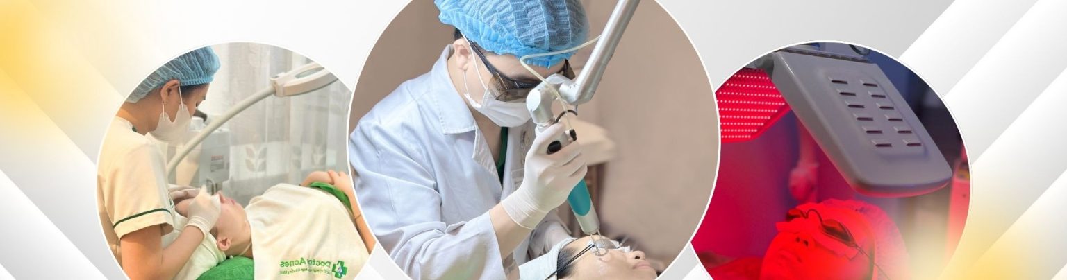 Điều trị thâm nám bằng laser pico discovery tại Doctor Acnes