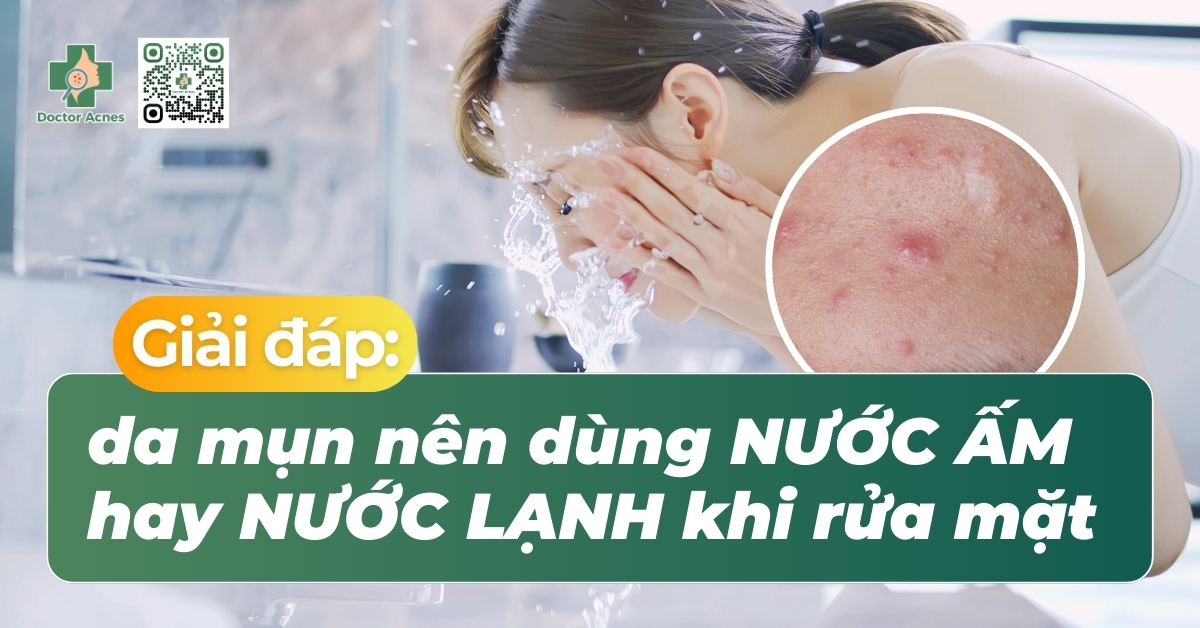 Giải đáp: da mụn nên rửa mặt bằng nước ấm hay lạnh?