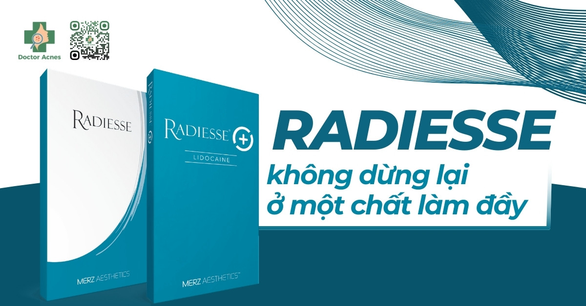 Radiesse - chất làm đầy giúp trẻ hóa da