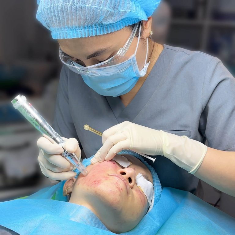 Platelet-Rich Plasma (PRP) for scar treatment - Doctor Acnes ...
