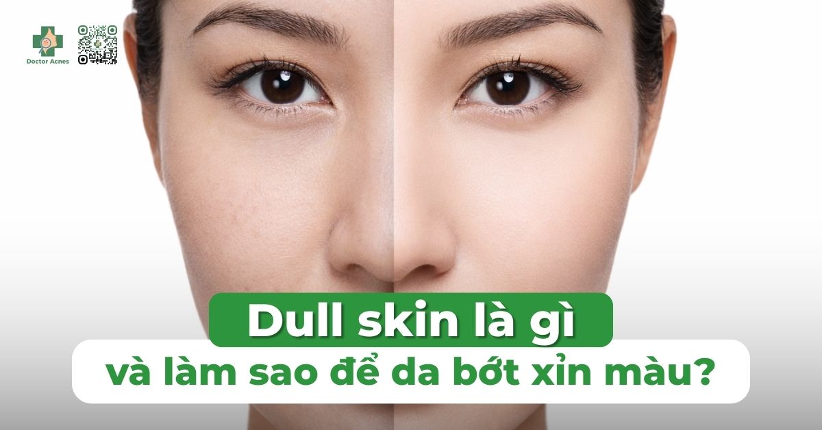 Dull skin là gì và làm sao để da bớt xỉn màu? - Phòng khám Da liễu ...